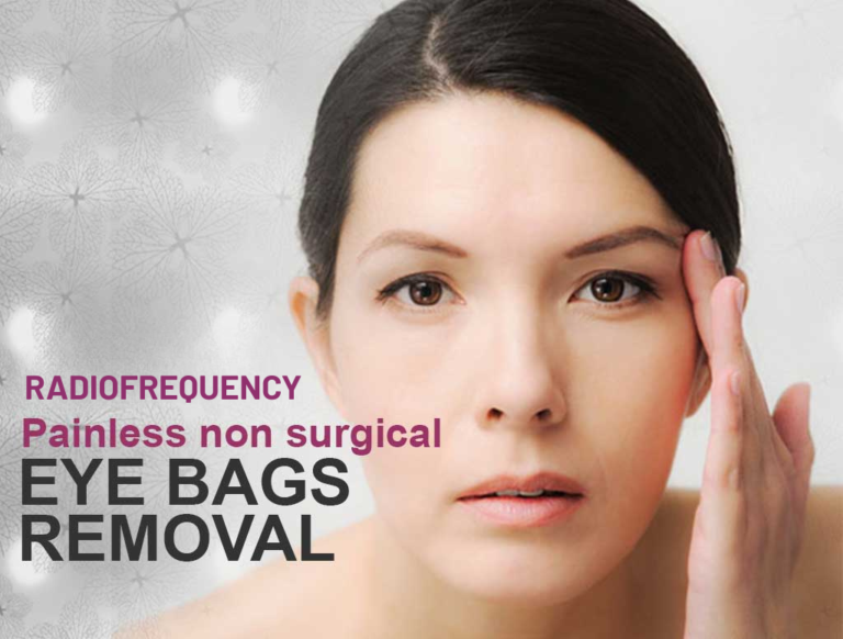 Non-Surgical Eye Bag Removal | Lim Clinic Aesthetic Clinic